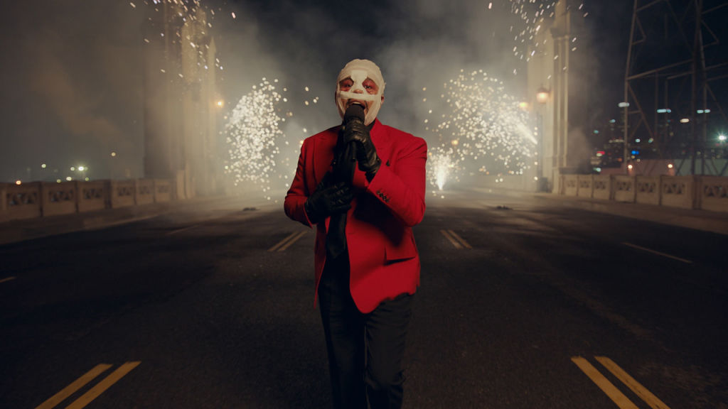 The Weeknd Shows Off His "New Face" Again