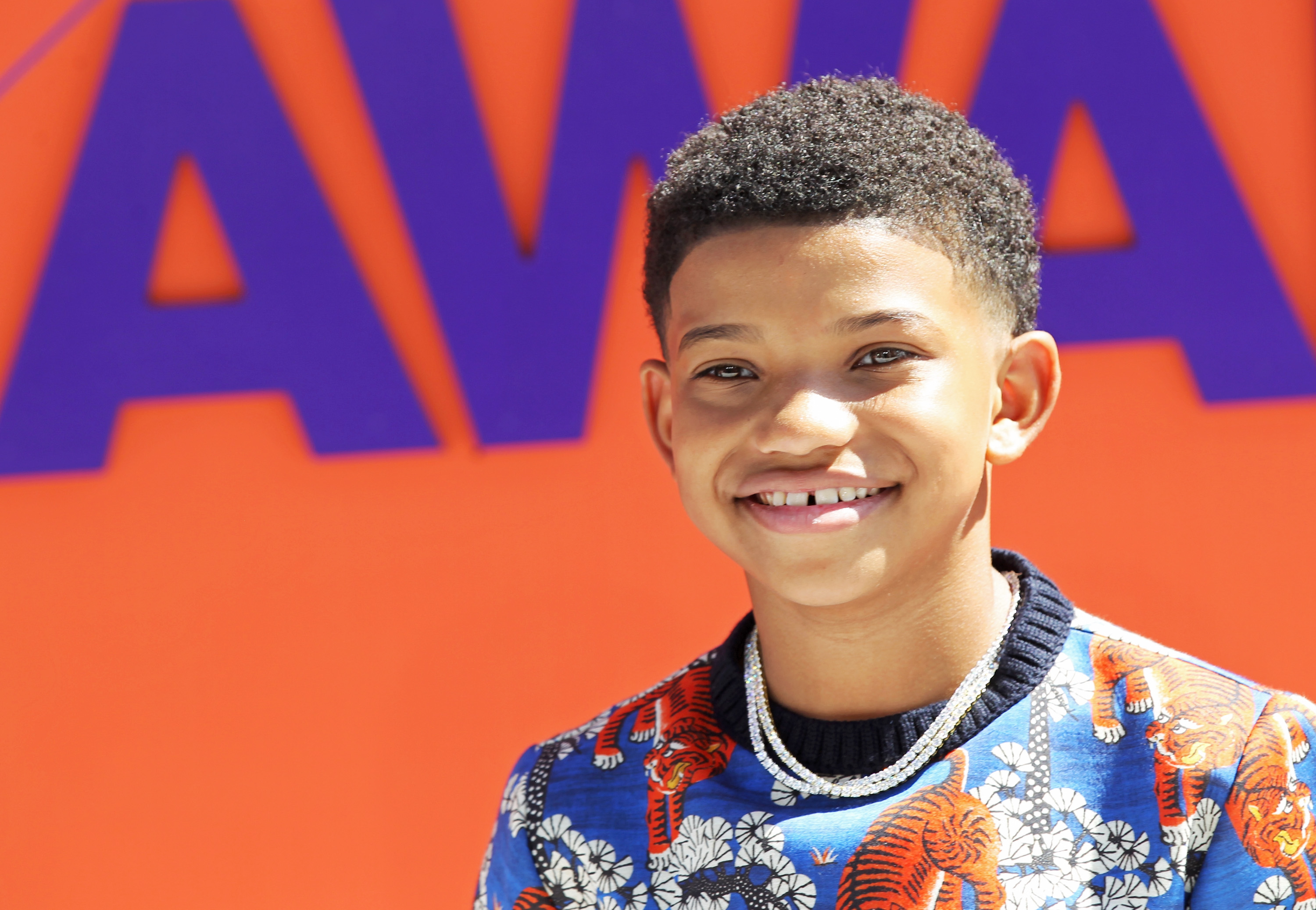 Fabolous Chipped Tooth