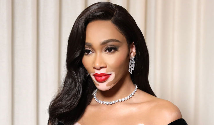 Winnie Harlow Debuts Matching Hair Color To Kyle Kuzma In Sweet Video